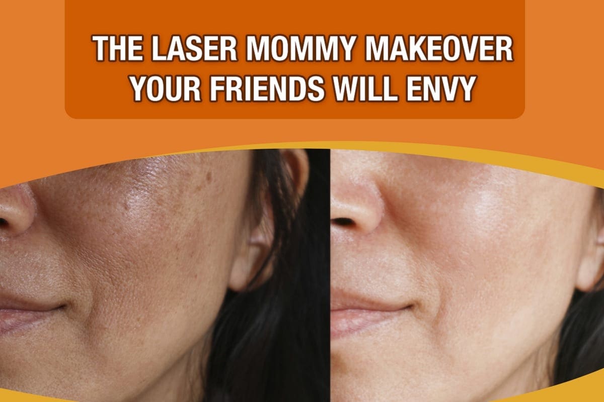 The Laser Mommy Makeover Your Friends Will Envy [Infographic]