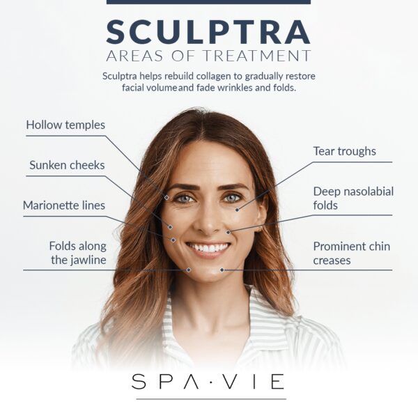 Sculptra Areas of Treatment